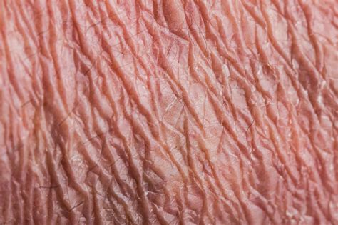 What Is The Best Lotion For Crepey Skin On Arms And Legs Greenway Biotech Greenway Biotech