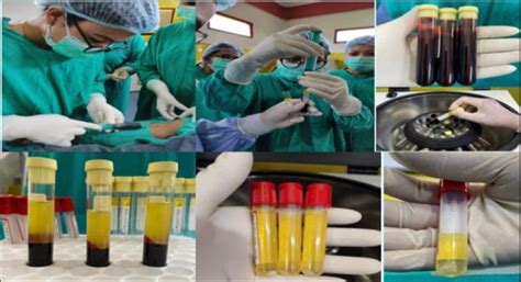 Steps Of Prp Preparation Download Scientific Diagram