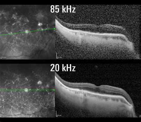 Raghav Narasimhan Posted On Linkedin