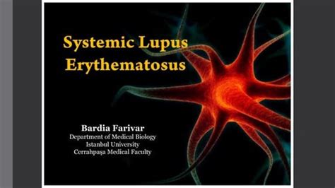 Systemic Lupus Erythematosus Pdf