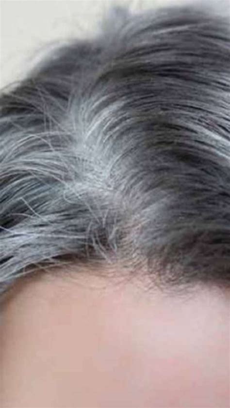 कम उम्र में हो रहे बाल सफेद अपनाएं ये 5 घरेलू उपाय