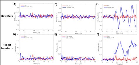 Ovarian Cancer Detection Using Photoacoustic Flow Cytometry