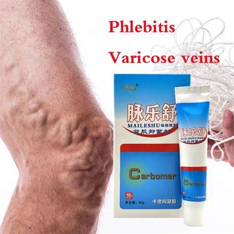 Phlebitis Of The Vein Phlebitis Superficial Thrombophlebitis Nhs