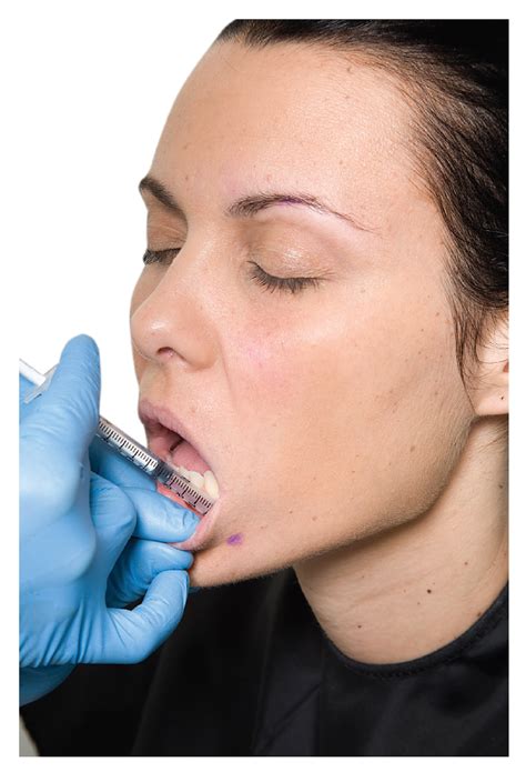Chapter 5 Anesthetic Block Plastic Surgery Key