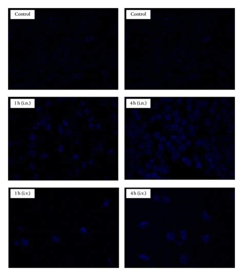Qualitative Localization Of Dapi Loaded Plga Nanoparticles In Brain