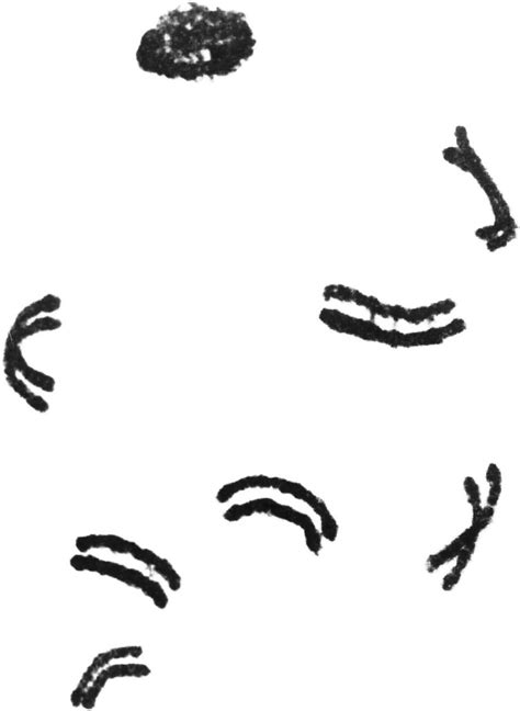 Thermocyclops Crassus S Fischer 1853 Spermatogenesis Chiasmatic