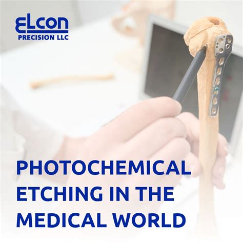 Elconprecision Medicalinnovation Photochemicaletching Precisionengineering