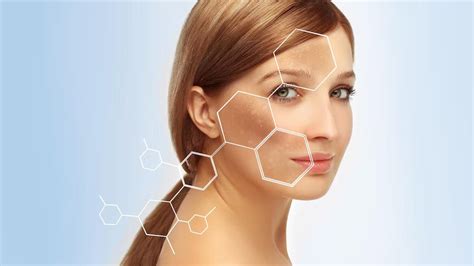 How To Treat Hyperpigmentation Based On Your Skin Type