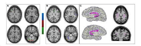 Functional Mri And Dti A Functional Mri With Language Dedicated
