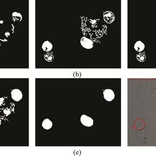 Cells Segmentation Steps On The Image Given In Fig B A Initial Download Scientific
