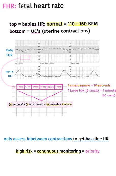 Interpreting Fetal Heart Tracings Rzbgcl