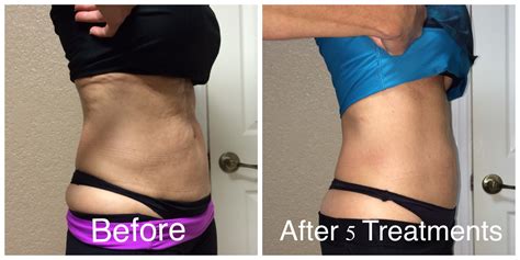 Plastic Surgery Of Texas Dr Tittle