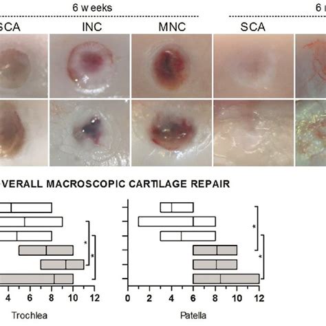 Macroscopic Assessment Of Cartilage Repair For Kissing Lesions The