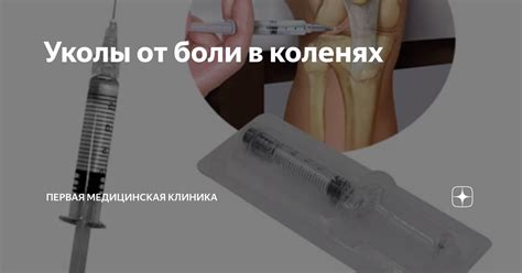 Уколы от боли в коленях Первая Медицинская Клиника Дзен