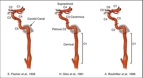 Essential Neurovascular Anatomy Springerlink