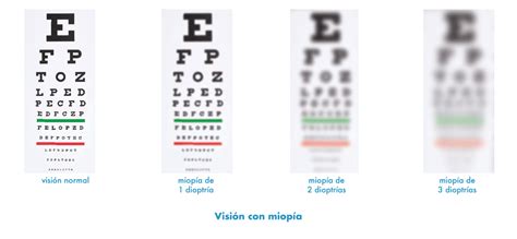 SABES QUÉ SIGNIFICA LA GRADUACIÓN DE TUS GAFAS Jose Luis Optico