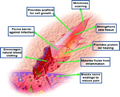 Fig 5 Msc Laden Hydrogels Can Prohibit Chronic Inflammation And
