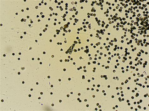 Zeiss Axio Imager 2 Imager D2 Led Fluorescence Phase Contrast Microscope