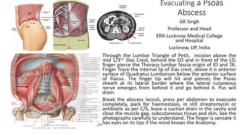 Psoas Abscess Anatomy