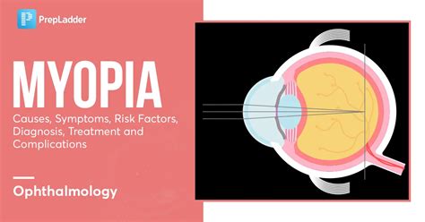 Myopia Causes Symptoms Risk Factors Diagnosis Treatment And