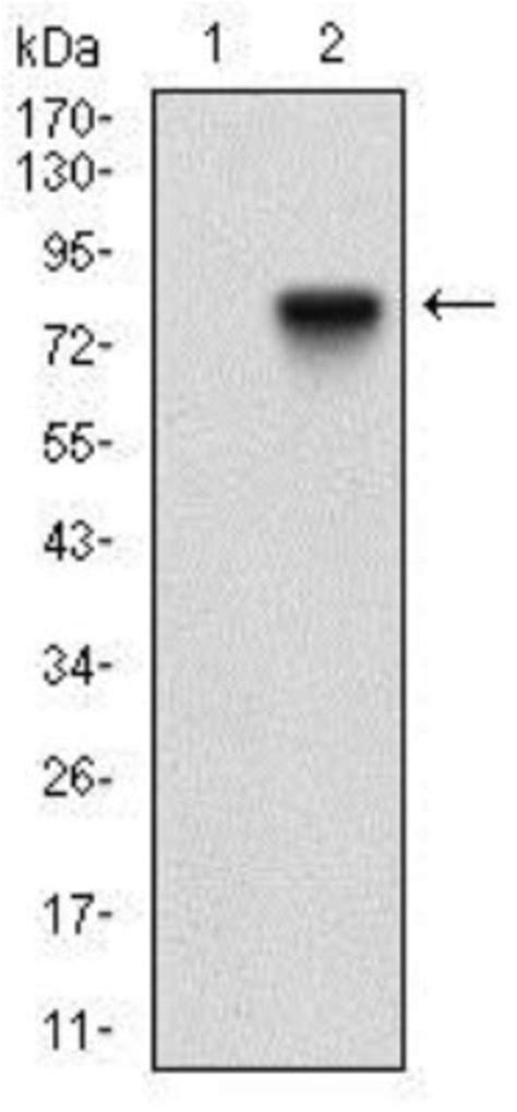 5 Nucleotidasecd73 01 Ml