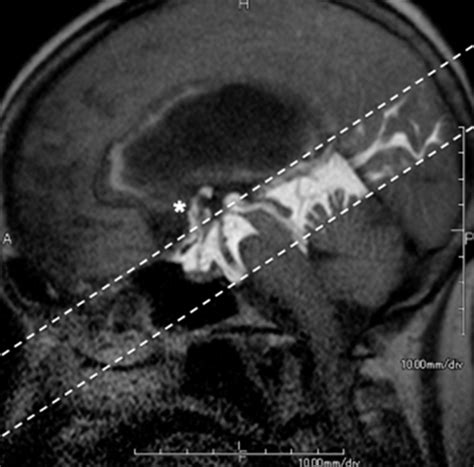 Fig 3 Current And Emerging Mr Imaging Techniques For The Diagnosis