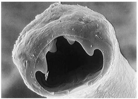 Hookworm Under Electron Microscope