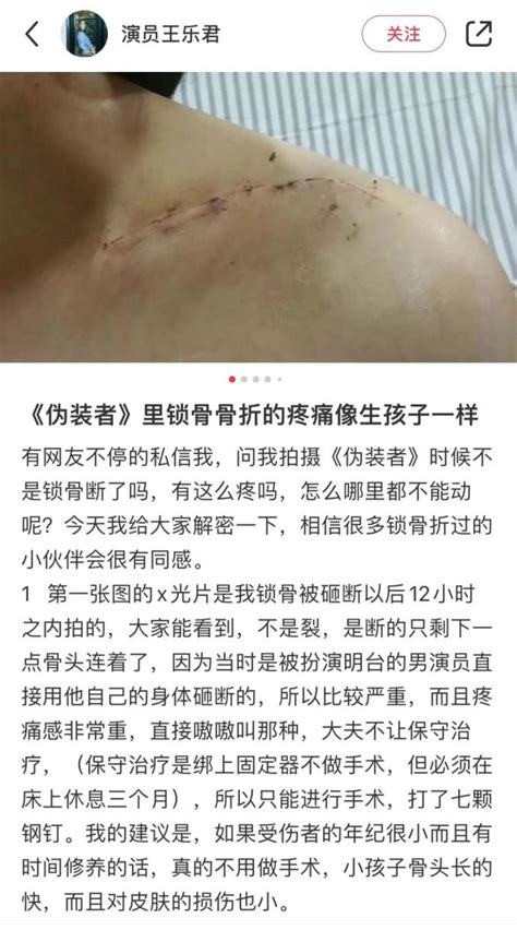 女演员发文控诉胡歌澎湃号·媒体澎湃新闻 The Paper