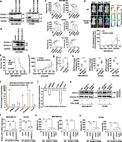 The Tumor Suppressive Effects Of Rcan14 In Breast Cancer Cells By
