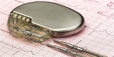 Difference Between Pacemaker And ICD