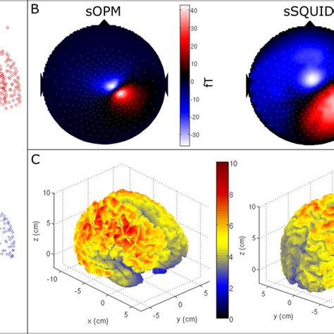 Pseudo Continuous Asl Difference Perfusion Images Δm At 7 T Top And