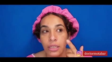 فیلم واقعی لیفت صورت و تزریق چربی به صورت نماشا