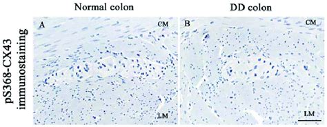 Cx43 Phosphorylated At Serine 368 Ps368 Cx43 Immunostaining No