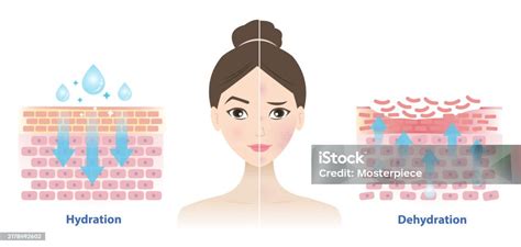 Comparison Of Hydration And Dehydration Skin On Woman Face Vector
