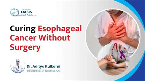 Can Esophageal Cancer Be Cured Without Surgery