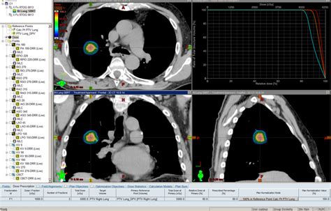 Sbrt Lung Catherine Cadieux B S R T T