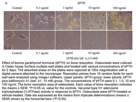Apexbio Bafilomycin A1 V Atpase Inhibitor Selective And Reversible