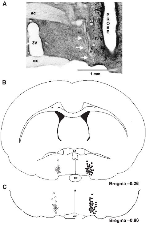 Anatomical Localization And Discharge Profiles Of The Recorded Neurons
