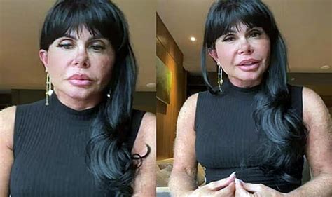 Gretchen Revela Problema De Saúde E Nega Nova Série De Procedimentos Estéticos Hoje Amazônia