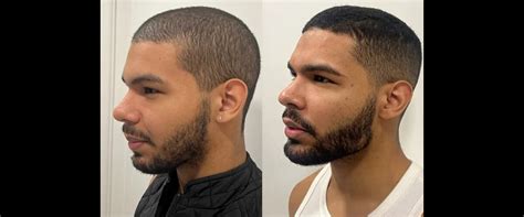 Foto Vyni Do Bbb 22 Foi Comparado Com O Rapper Drake Após