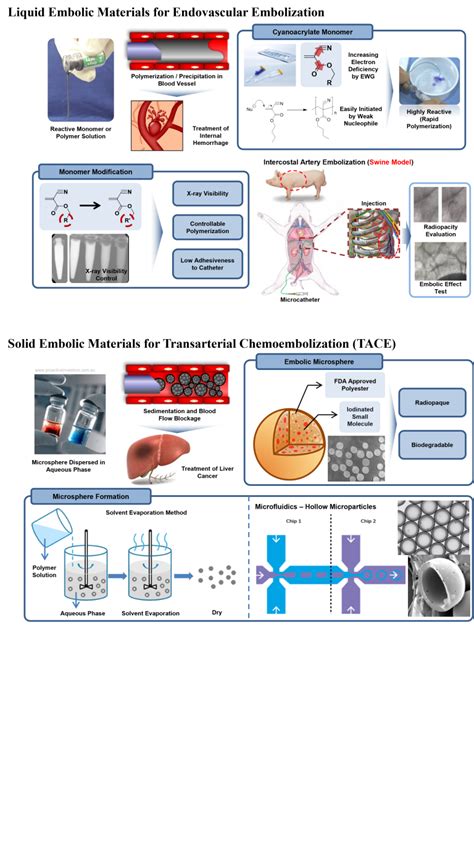 Embolic Materials 나노바이오재료연구실