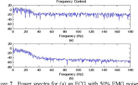 Figure 7 From Cancellation Of High Frequency Noise In Ecg Signals Using Adaptive Filter Without