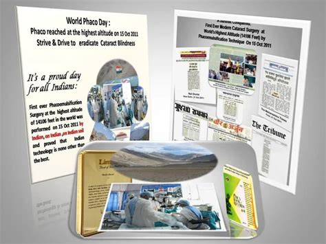 What Is Phacoemulsification Overview Benefits And Expected Results Adoctor