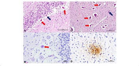 Histopathologic And Immunohistochemical Findings Observed In A