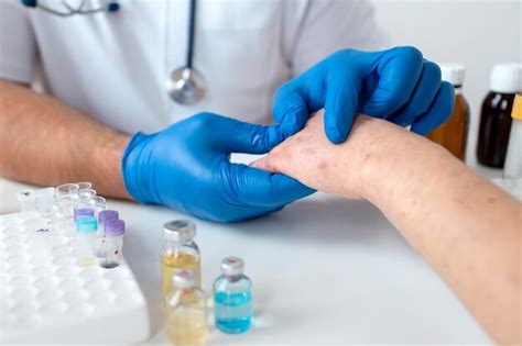 Common Psoriasis Symptoms And Solutions