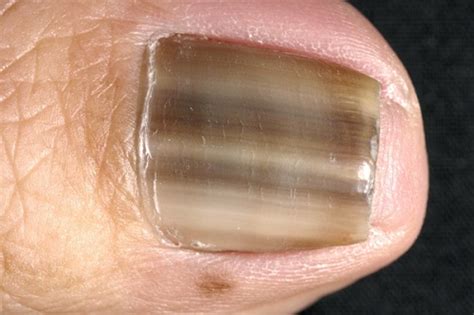 15 Disturbing Things Your Nails Reveal About Your Health Fallbrook247