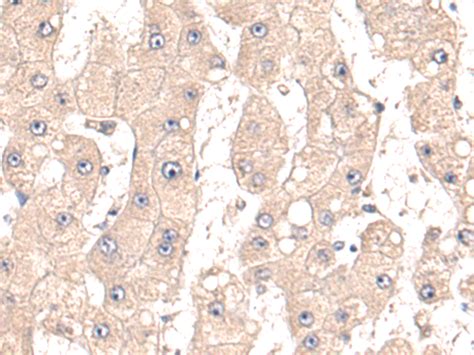 兔抗CER 多克隆抗体 Anti CER rabbit polyclonal antibody 生命科学产品与技术服务 生工生物工程 上海 股份有限公司