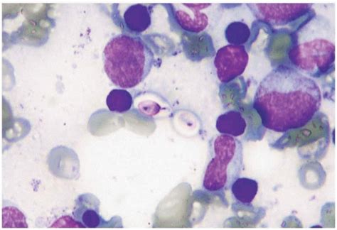 Infectious Disease And Related Topics Basicmedical Key