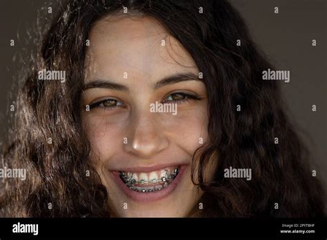 Portrait Of Pretty Girl With Curly Hair Smiling And Showing Metal Braces On Teeth Stock Photo