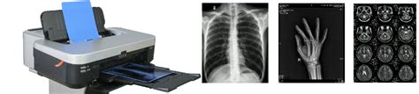 Inkjet Film Printer X Ray Dry Film Printer Medical Image Film Printer